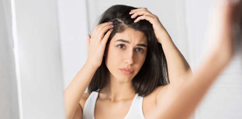 Caspa en el pelo: ¿Qué es? Tipos de caspa y como eliminarla | Blog Druni