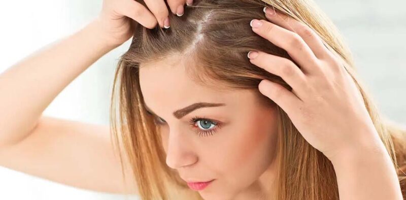 Diferencias entre caspa seca y caspa grasa | Blog Druni