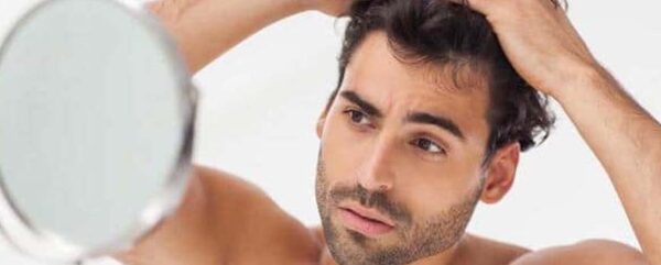 Cómo saber si te vas a quedar calvo | Blog Druni