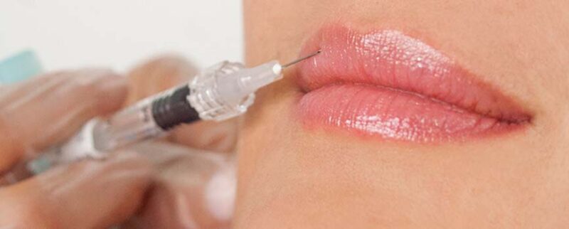 Todo lo que necesitas saber sobre el ácido hialurónico reticulado: Usos ...