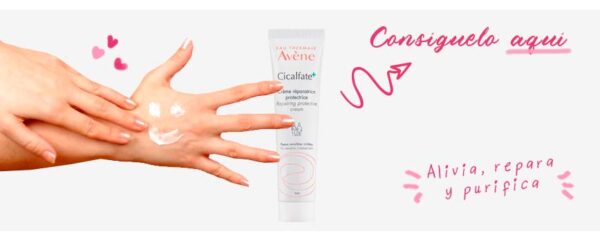 Las mejores cremas para quemaduras que no puede faltar en el botiquín ...