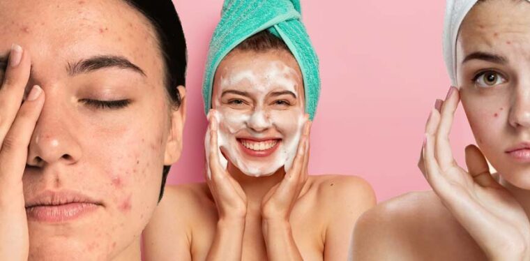 Granos enquistados: Causas, tratamiento y prevención | Blog Druni