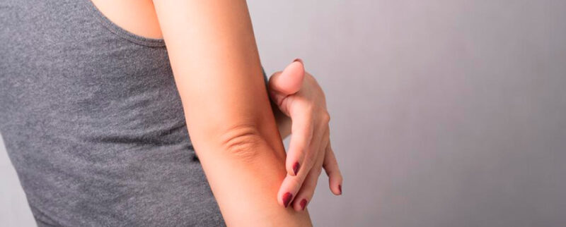 Codos ásperos y secos: Las mejores cremas para codos secos | Blog Druni