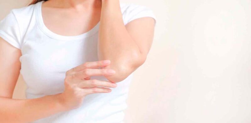 Codos secos y oscuros: Soluciones sencillas para mejorar su aspecto ...