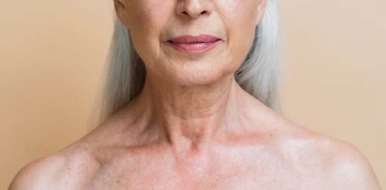 Codos ásperos y secos: Las mejores cremas para codos secos | Blog Druni