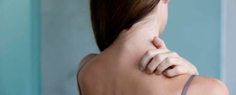 Hongos en la piel: ¿Cómo identificarlos y cómo tratarlos? | Blog Druni