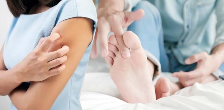 Hongos en la cara: causas, síntomas y tratamiento | Blog Druni