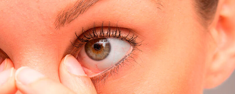 Infección ocular: ¿Qué es y cómo evitarla? | Blog Druni