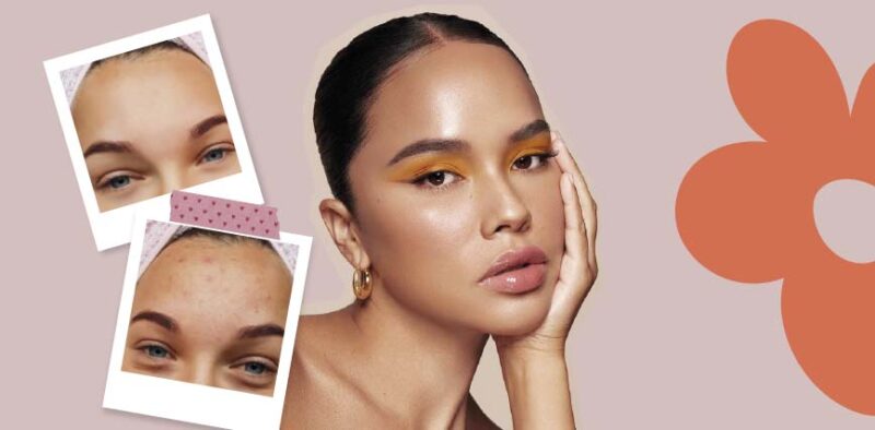 Granos en el labio: qué hacer y cómo tratarlos | Blog Druni