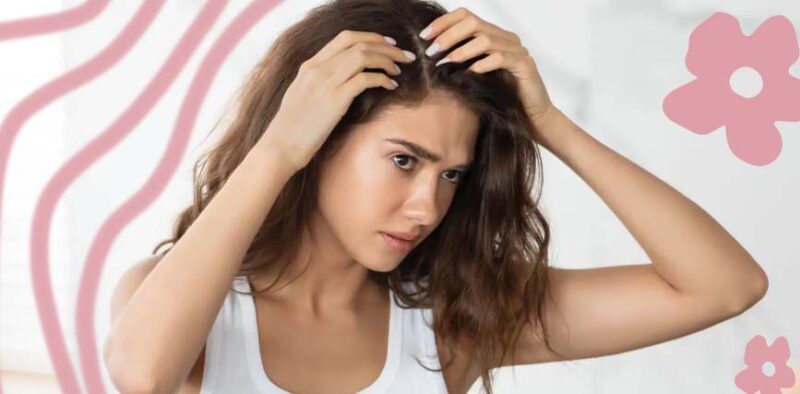 Cómo eliminar la caspa en un día: ¡Recupera tu cabello limpio y ...