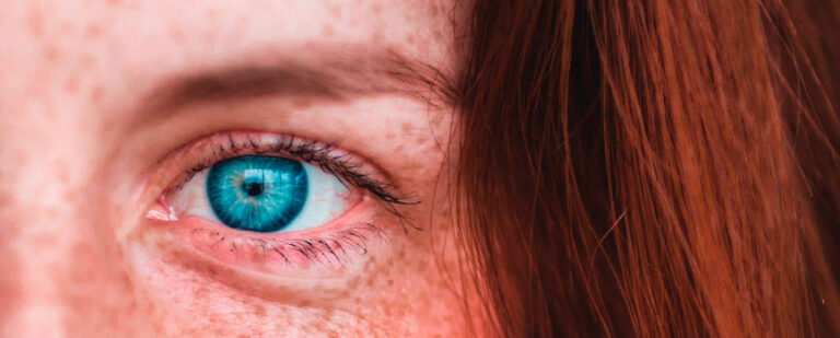 Manchas marrones en la piel: ¿por qué aparecen y cómo tratarlas? | Blog ...