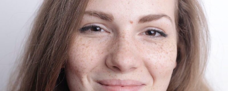 Manchas marrones en la piel: ¿por qué aparecen y cómo tratarlas? | Blog ...