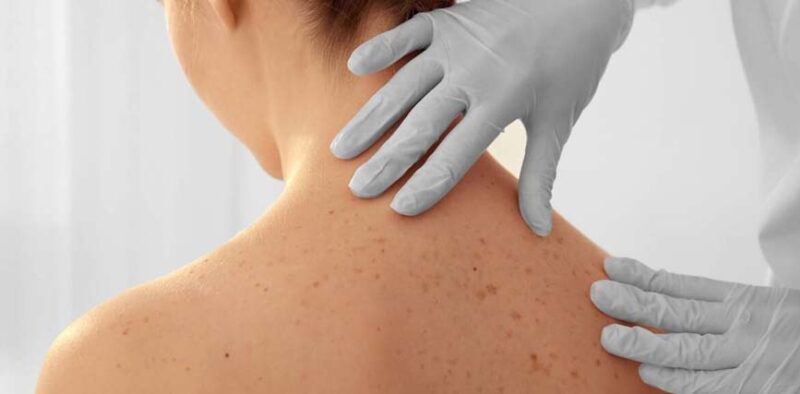 Codos ásperos y secos: Las mejores cremas para codos secos | Blog Druni