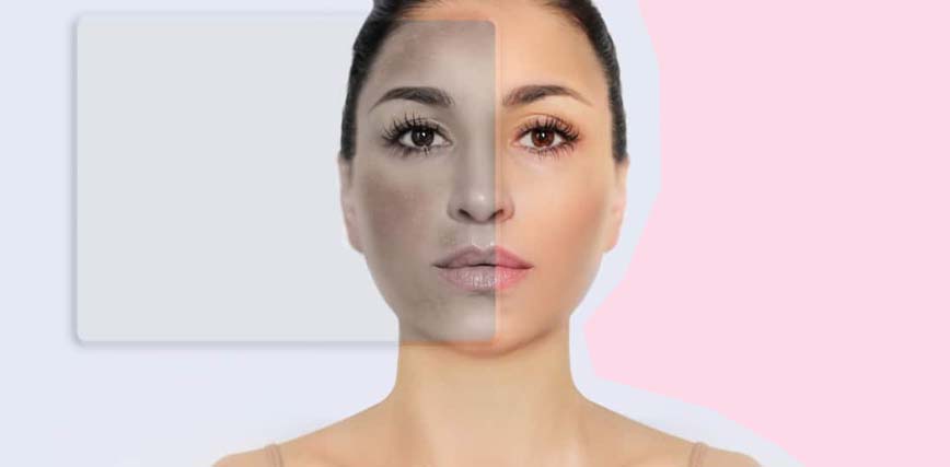 Manchas negras en la piel: ¿por qué aparecen y cómo tratarlas? | Blog Druni