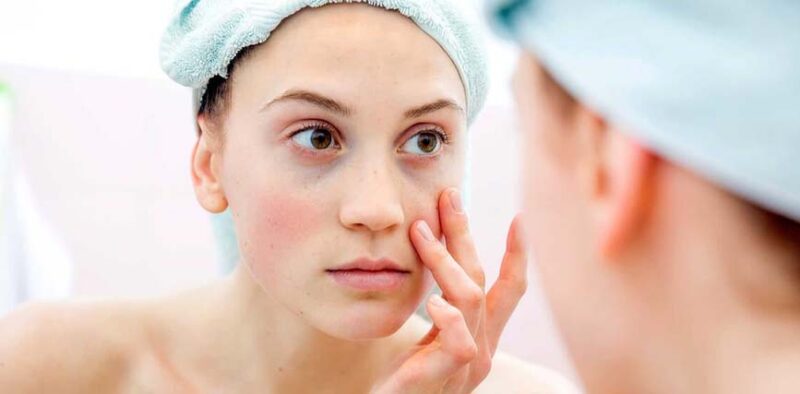 Ojeras moradas: ¿Qué son y cómo quitarlas? | Blog Druni