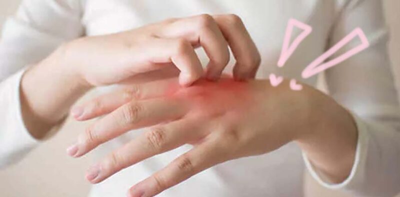 Picor en las manos: causas y remedios efectivos | Blog Druni