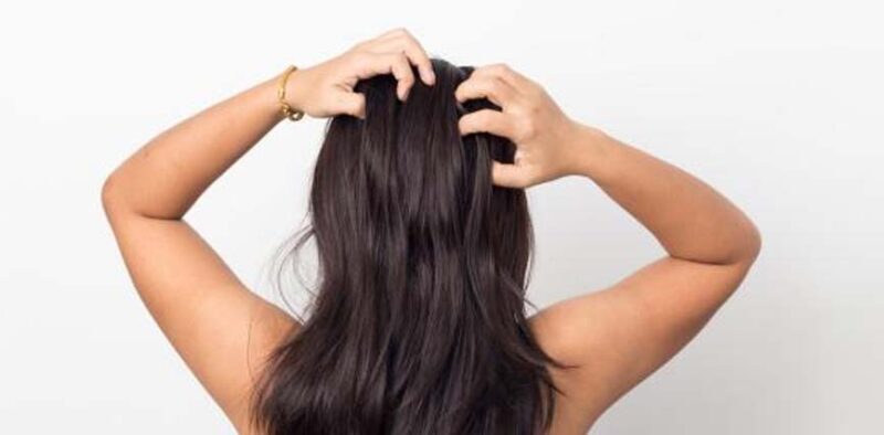 ¿Por qué me pica tanto el cuello? Principales causas | Blog Druni