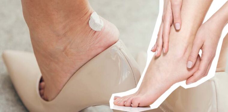 ¿Qué son las ampollas y por qué salen en la piel? | Blog Druni