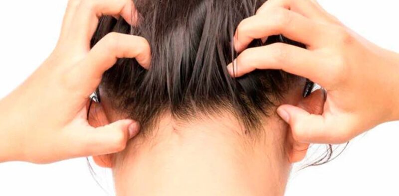 ¿Cómo curar la psoriasis en la cara? | Blog Druni