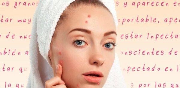 ¿Cómo curar un grano infectado? | Blog Druni