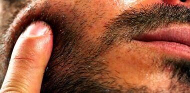 ¿Cómo tratar la dermatitis seborreica en la barba? | Blog Druni