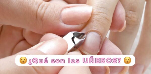 ¿Qué son los uñeros? ¿Cómo curarlos correctamente? Te lo contamos ...