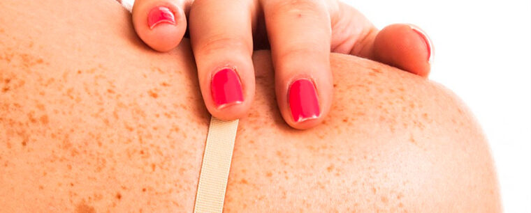 Melasma en la piel: causas, síntomas y cómo eliminarlo eficazmente ...