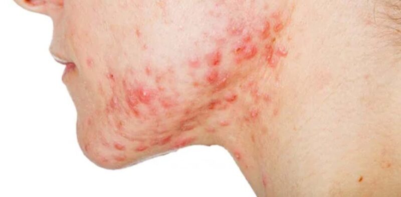 Lyocell: ¿Qué es y por qué es el tejido del futuro? | Blog Druni