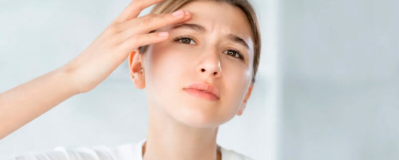 Exceso de sebo en la piel: Causas y soluciones efectivas | Blog Druni