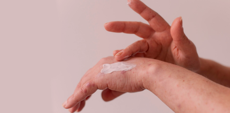 ¿Qué son los uñeros? ¿Cómo curarlos correctamente? Te lo contamos ...