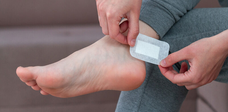 ¿Qué son las ampollas y por qué salen en la piel? | Blog Druni