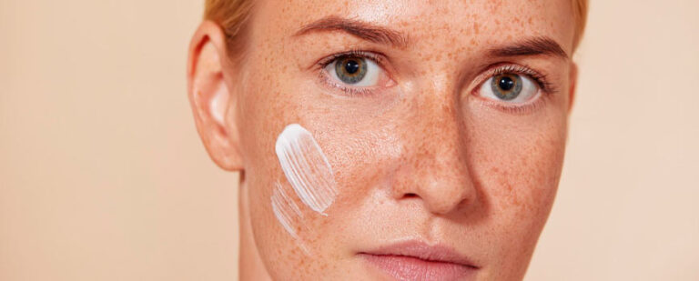 Pecas en la piel: cómo eliminarlas o disimularlas de forma segura ...