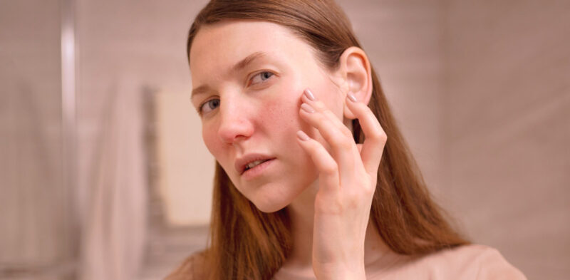 Hongos en las axilas: causas, síntomas y tratamiento | Blog Druni