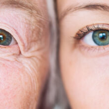 Cuidado íntimo: Métodos seguros para aclarar la zona íntima de forma ...