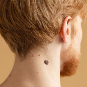 Cuidado íntimo: Métodos seguros para aclarar la zona íntima de forma ...