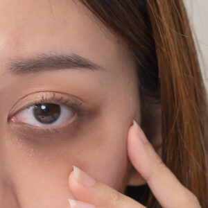 Cuidado íntimo: Métodos seguros para aclarar la zona íntima de forma ...