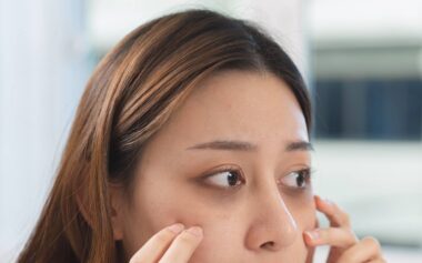 Ojeras moradas: ¿Qué son y cómo quitarlas? | Blog Druni